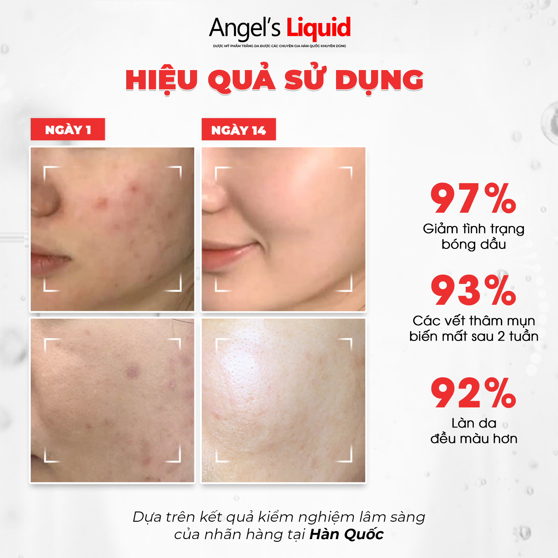 nuoc-than-angels-liquid-glutathione-niacinamide-cica-essence-150ml-7 ...